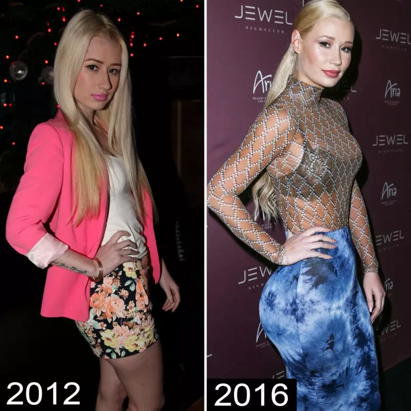 Iggy azalea တင်ပါး