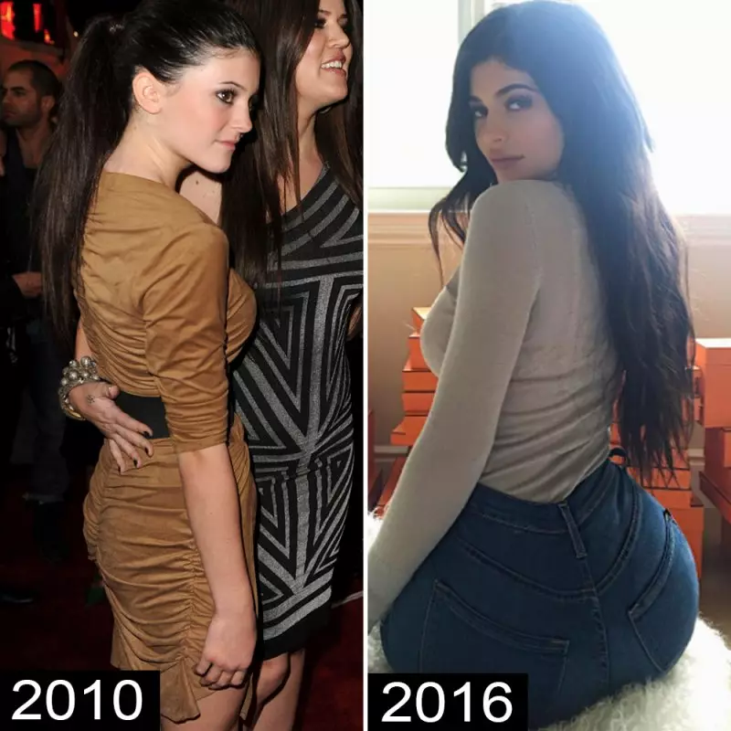 Kylie jenner တင်ပါး