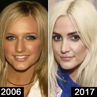 Ashlee Simpson lýtaaðgerð