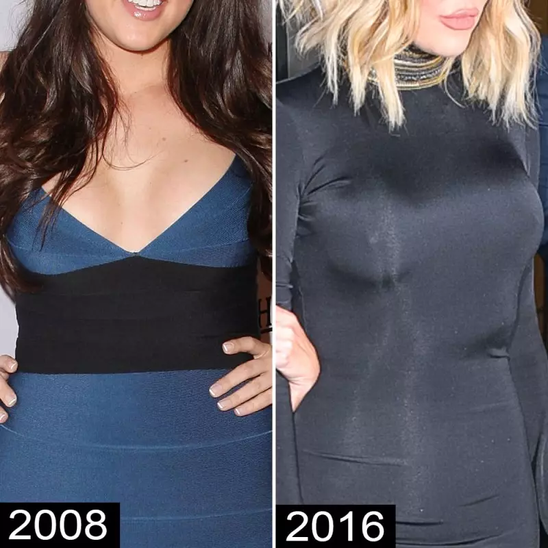 Khloe kardashian borsten