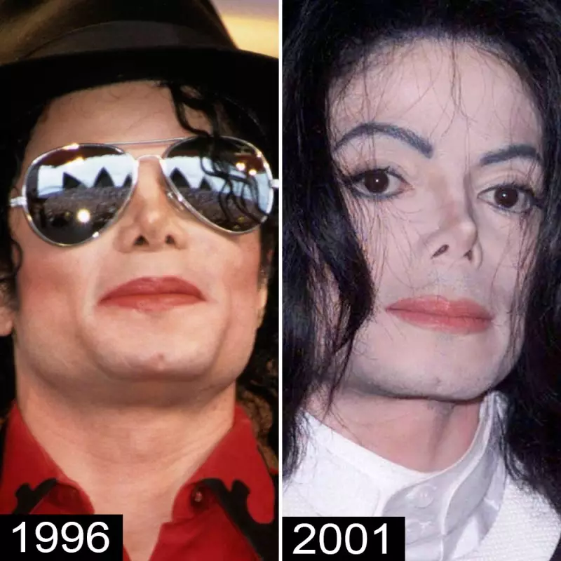 Twarz Michaela Jacksona 2001
