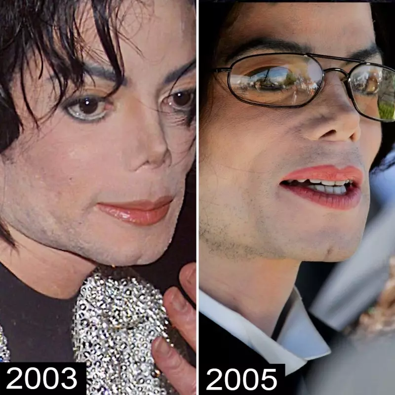 Nos Michaela Jacksona 2005