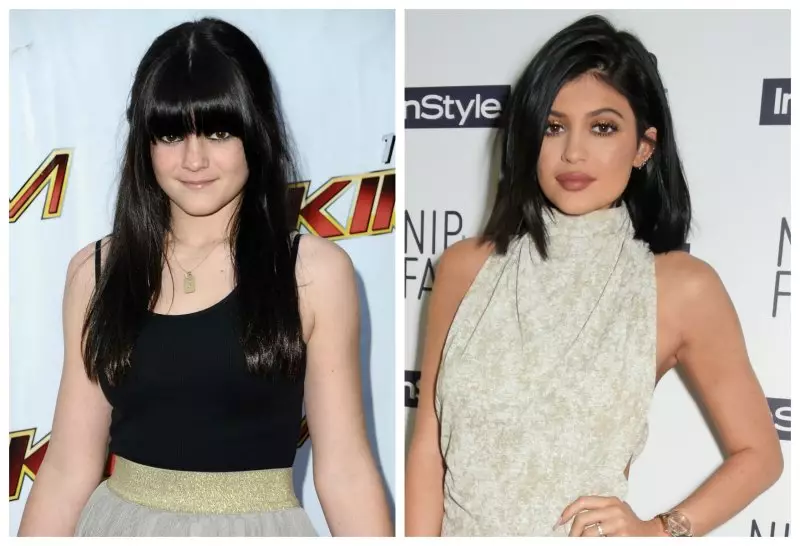 kylie jenner antes despues