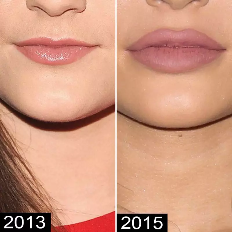 Kylie Jenner lūpos