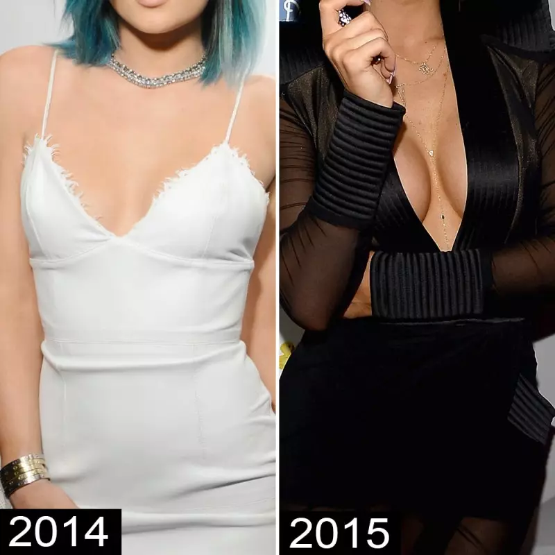 Kylie Jenner krūtis