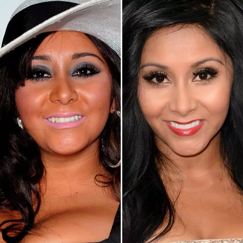 Snooki 貼面