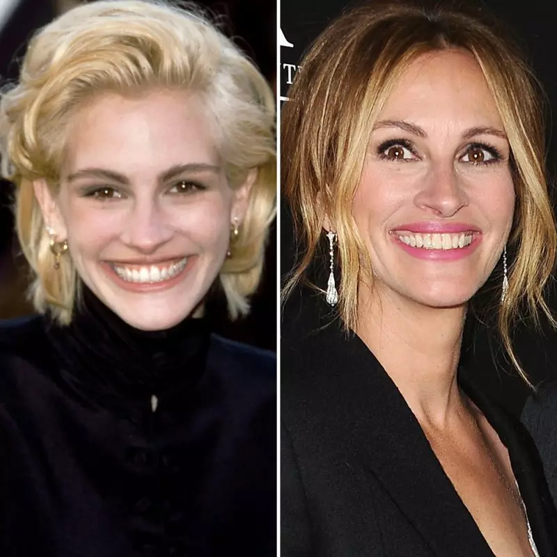 facettes julia roberts