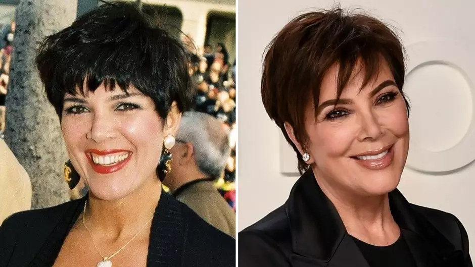 Kris Jenner phẫu thuật thẩm mỹ