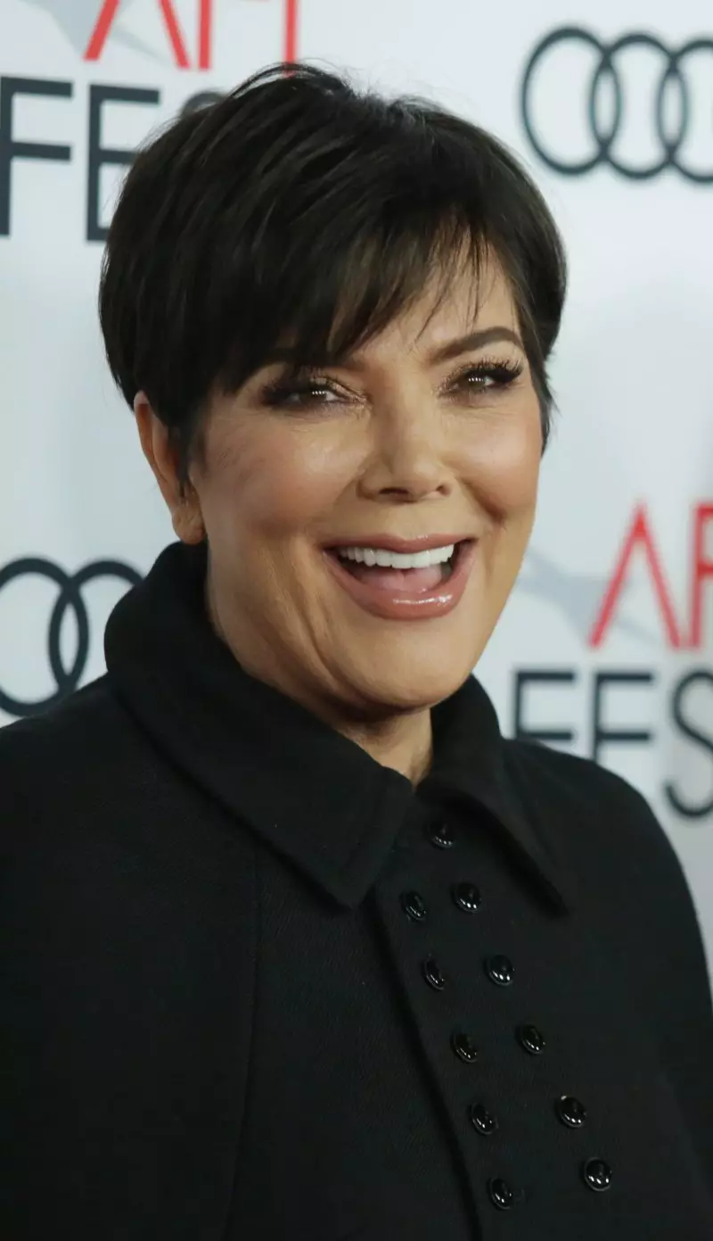 Kris Jenner phẫu thuật thẩm mỹ tháng 11 năm 2017