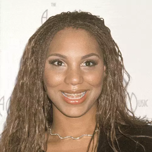 Chirurgie plastică Tamar Braxton