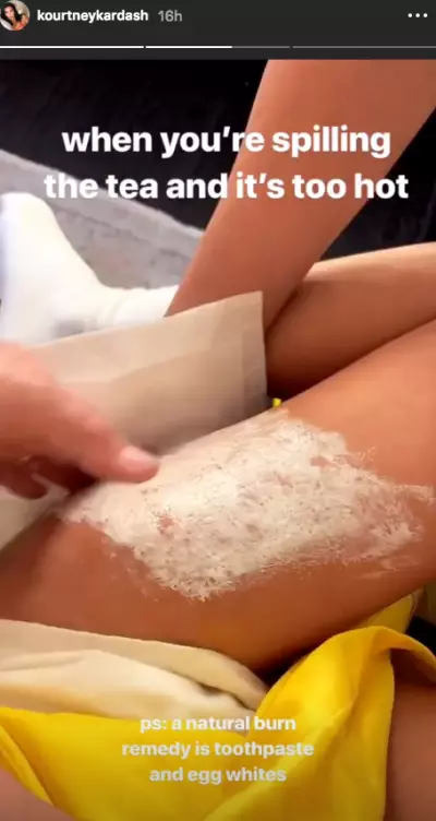 Videoja e Kourtney Kardashian në instagram për djegien e këmbëve