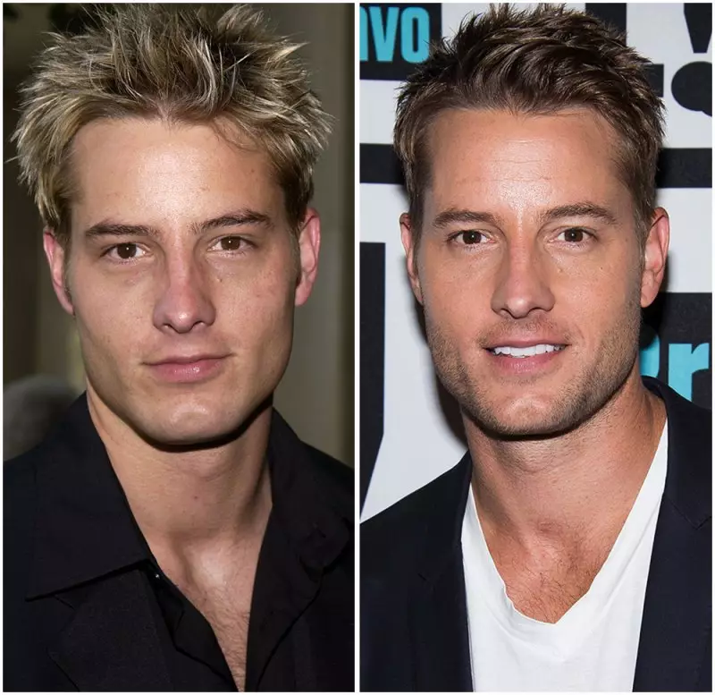 Justin hartley