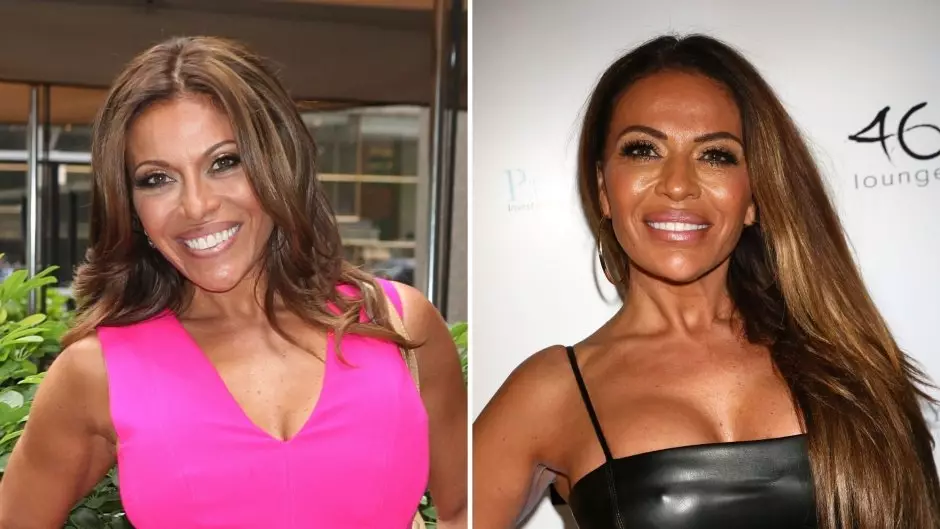 'RHONJ' Star Dolores Catania'nın Plastik Cərrahiyyə Prosedurları: Transformasiya Fotolarına baxın