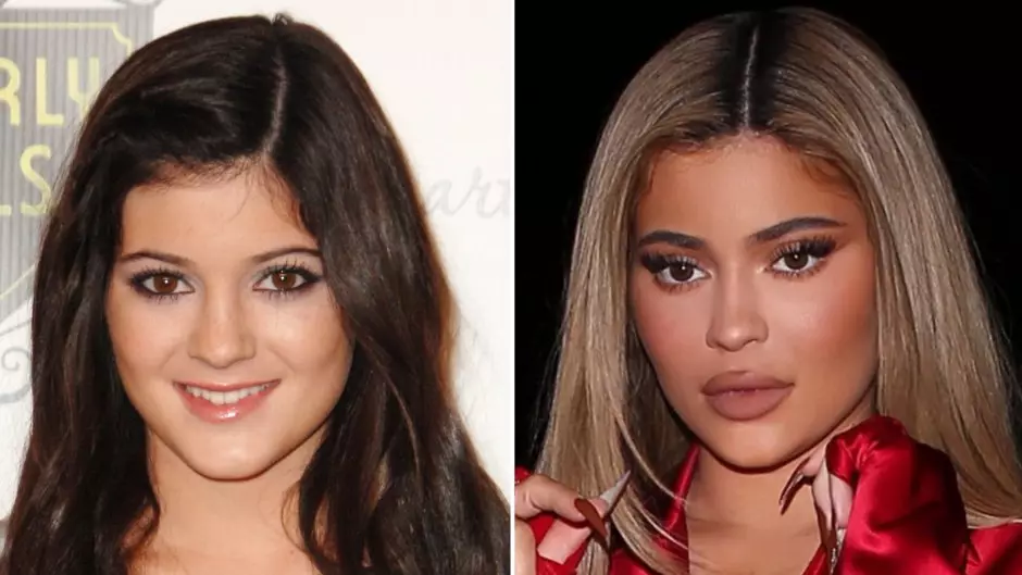 Kylie Jenner Yıllar Boyunca Plastik Cerrahi Hakkında Gerçek Oldu Her Zaman