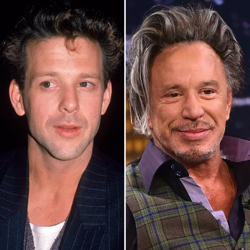 Mickey Rourke plastik cerrahi