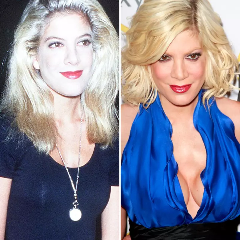 Tori spelling plastic surgery