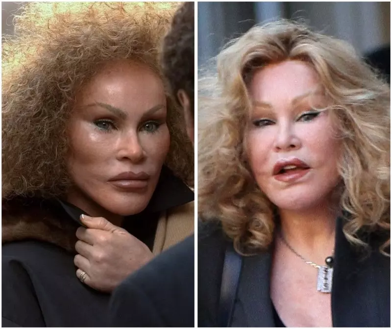 Jocelyn Wildenstein opereishene ea polasetiki