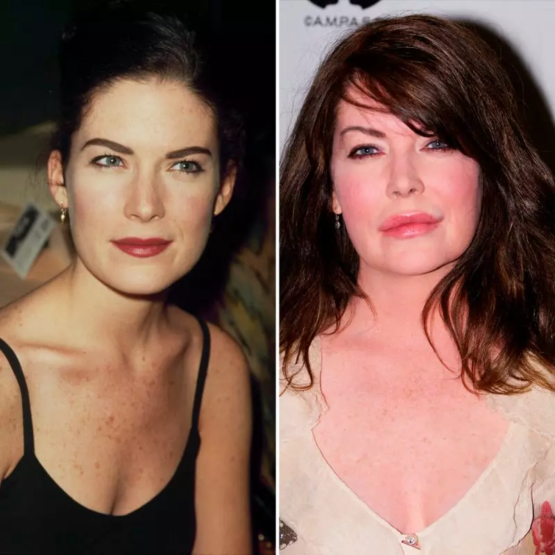 Lara flynn boyle cirurgia plàstica