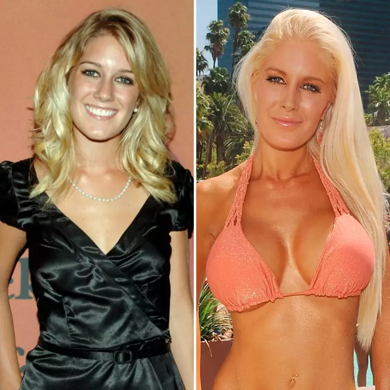 Heidi montag plastik cerrahi