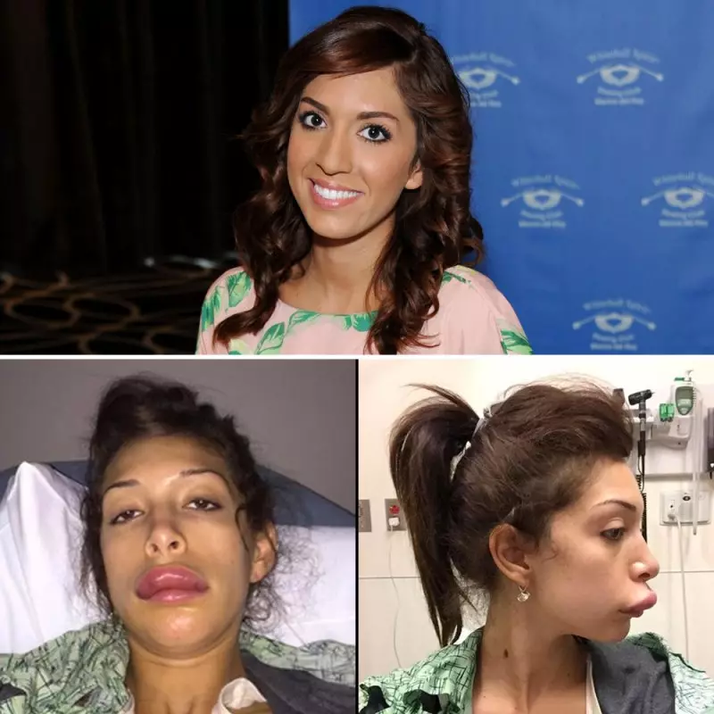 Farrah Abraham plastinė chirurgija