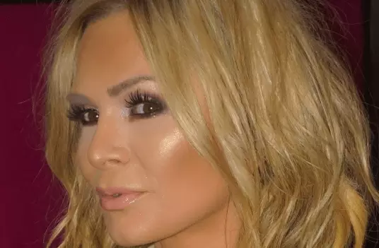 Tamra Riichter facelifting