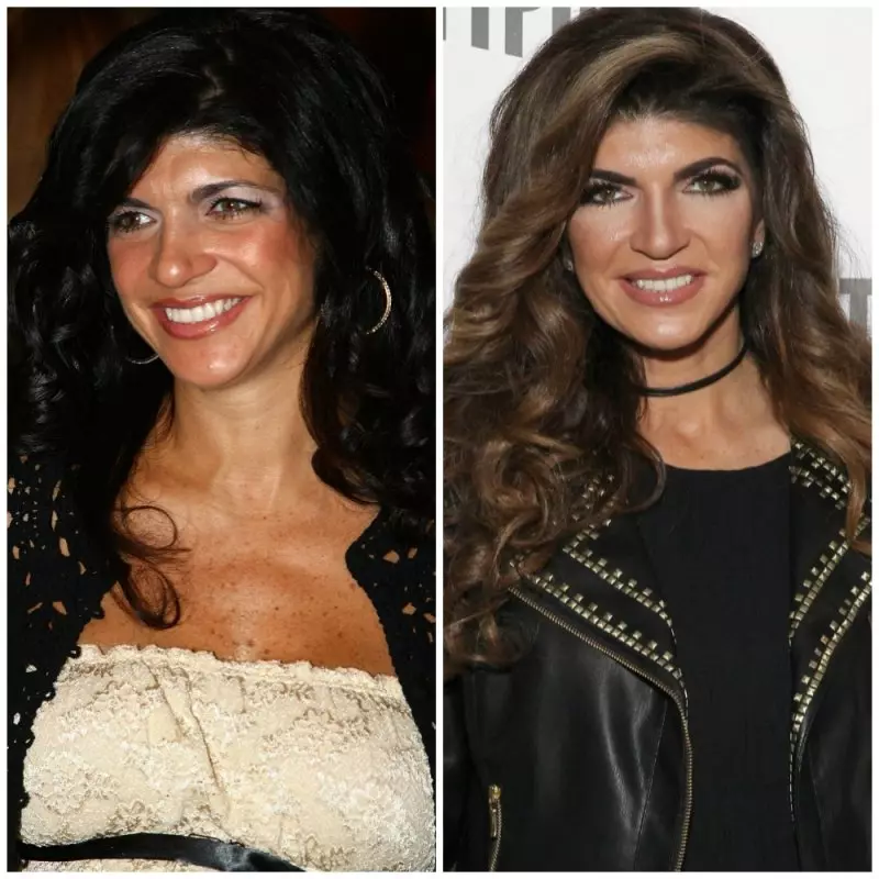 Namų šeimininkės plastinė chirurgija teresa giudice