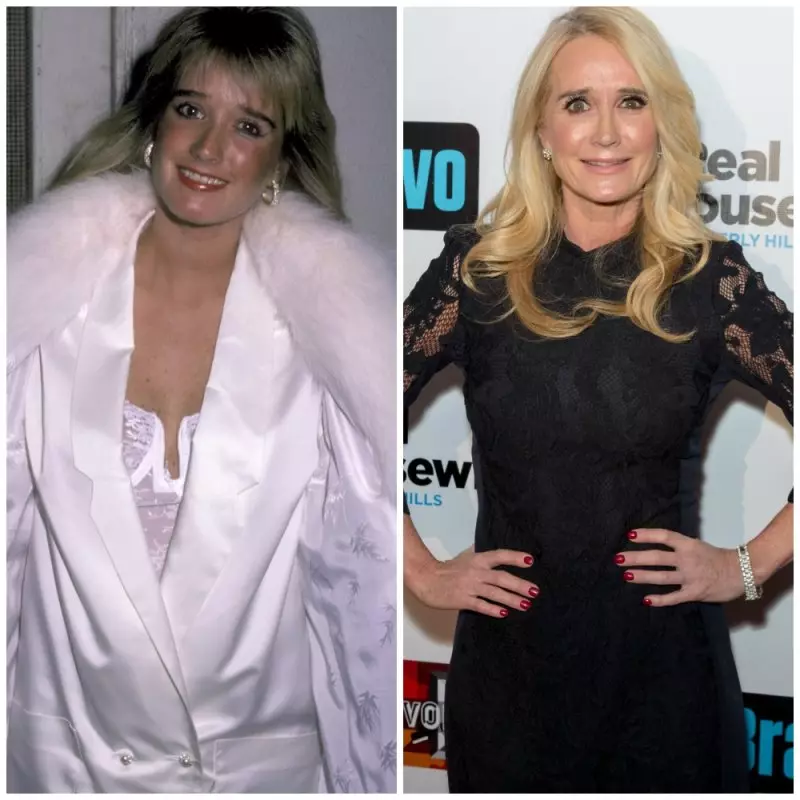 Amas de casa cirurxía plástica kim richards