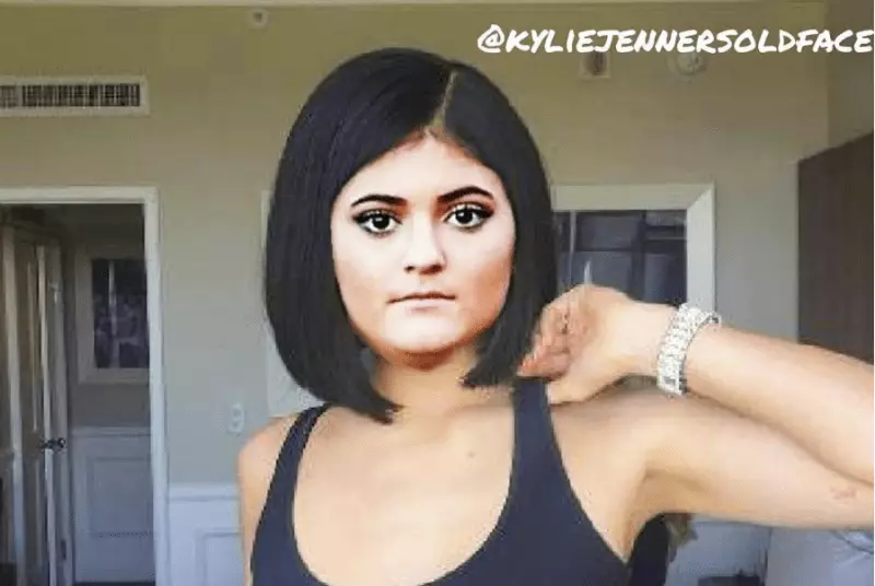 Kylie Jenner 늙은 얼굴 10