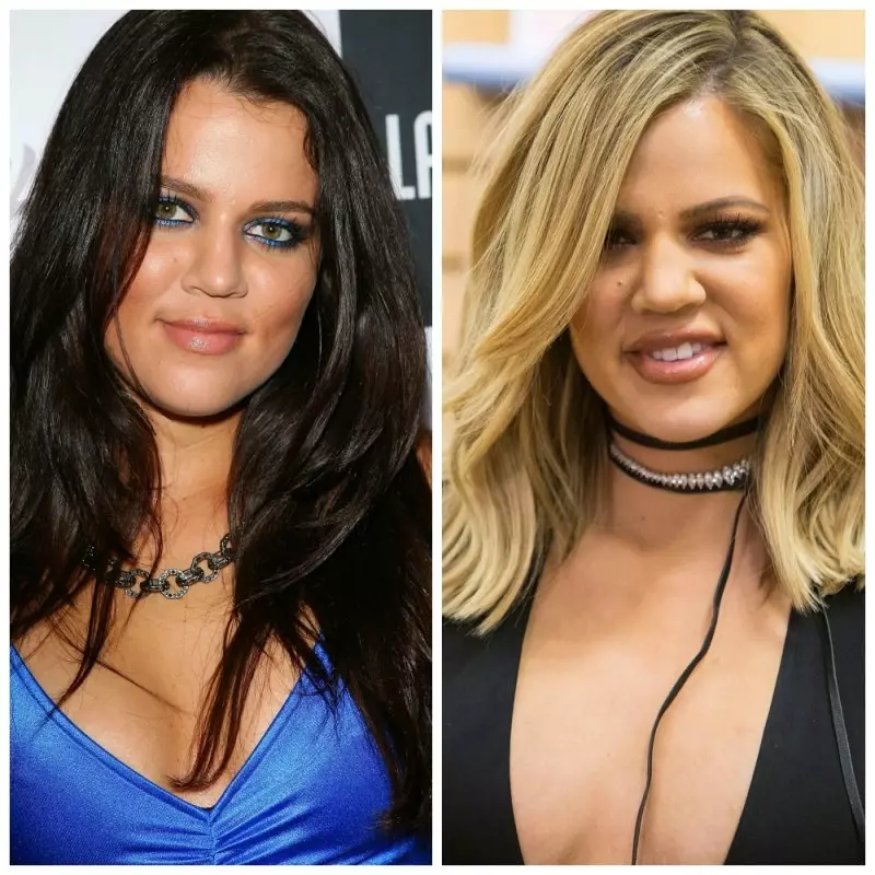 Operasyon plastik ale mal khloe kardashian