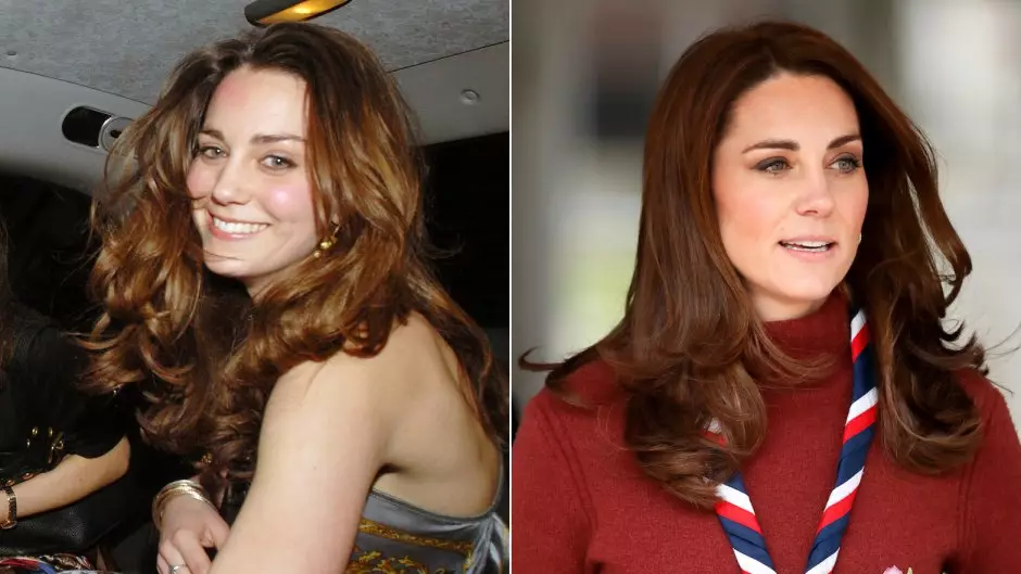 kate middleton plastic surgery oogqirha bacinga ukuba ufumana i-botox