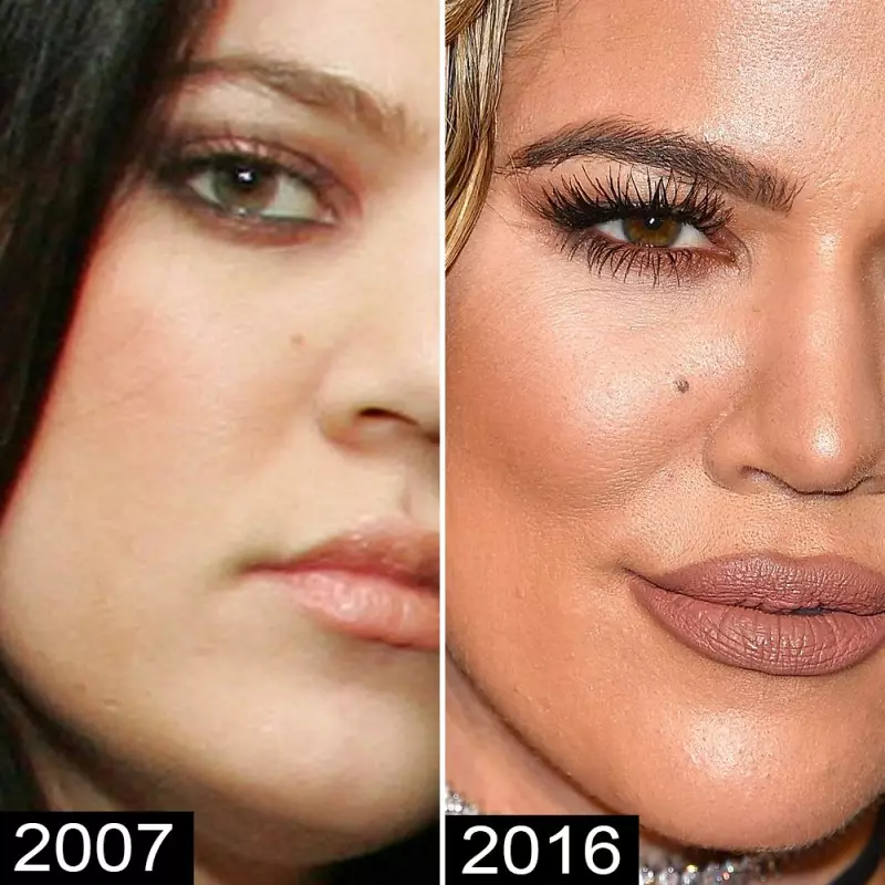 Maçãs do rosto Khloe kardashian