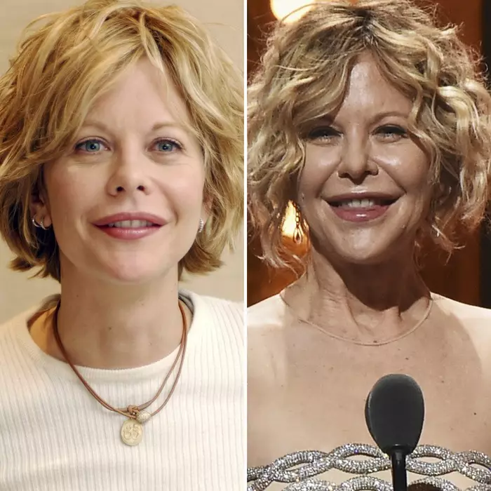 Cirurgia Plástica Meg Ryan