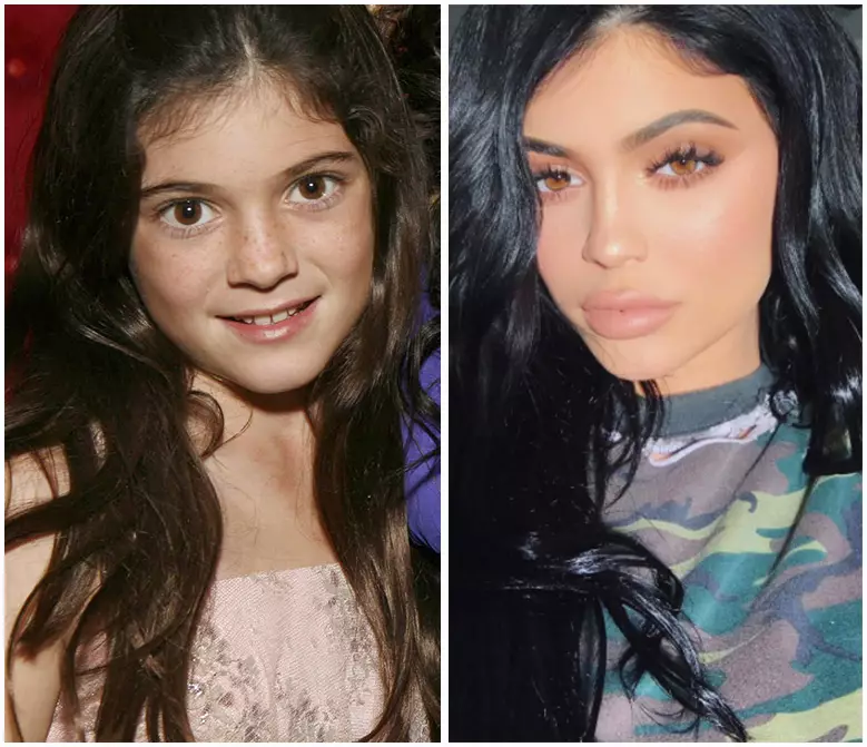 Kylie jenner kaniadto ug karon