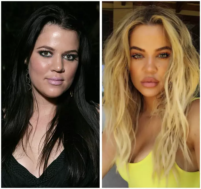 Khloe kardashian ဟိုတုန်းကရော အခုရော