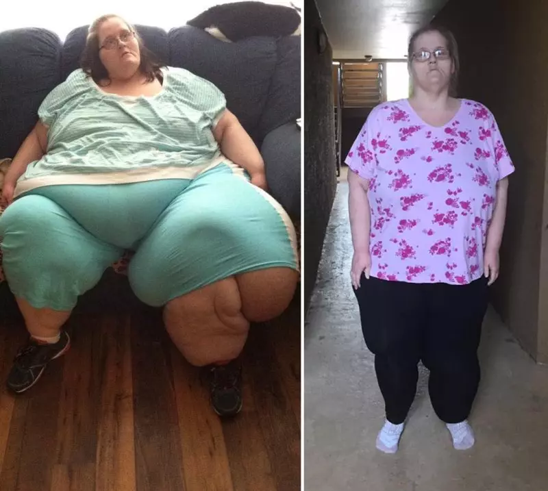 Charity 600 lb moyo