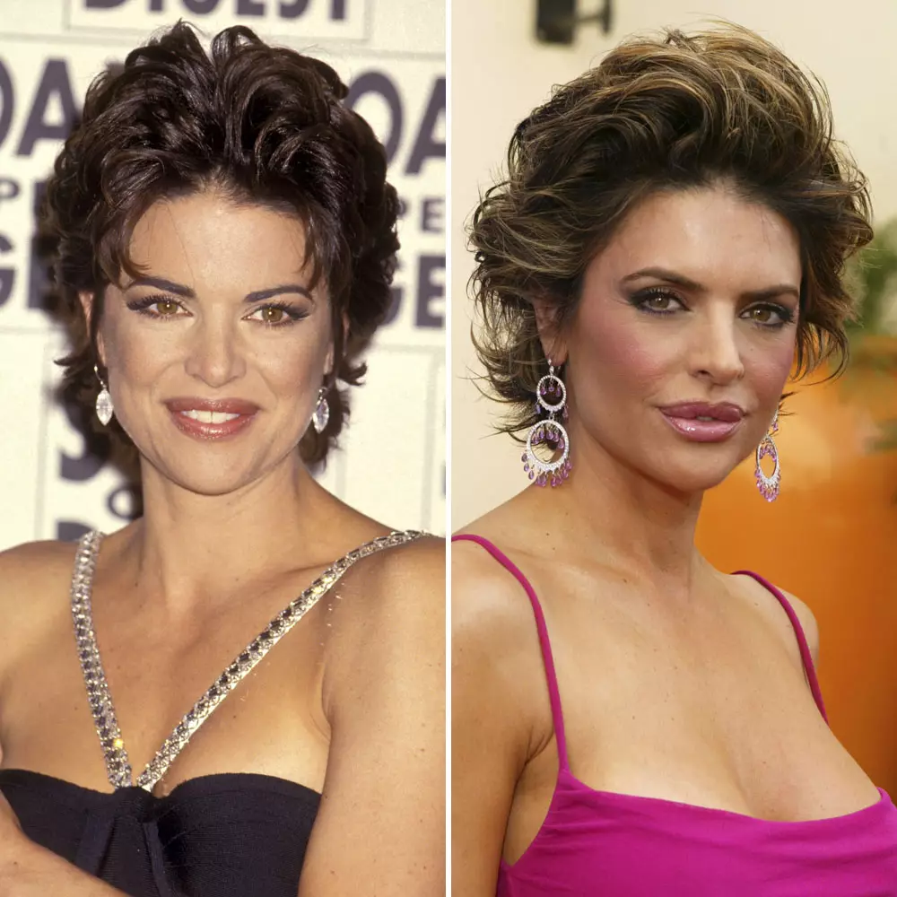 Lisa rinna operasi