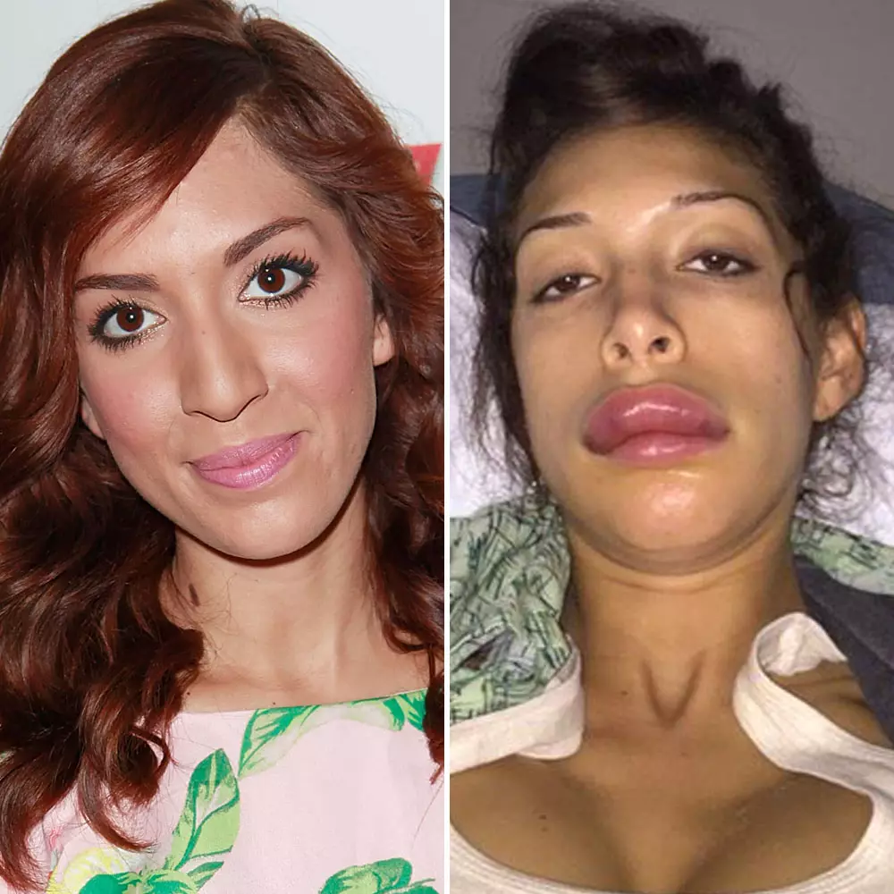 Operasi Farrah Abraham