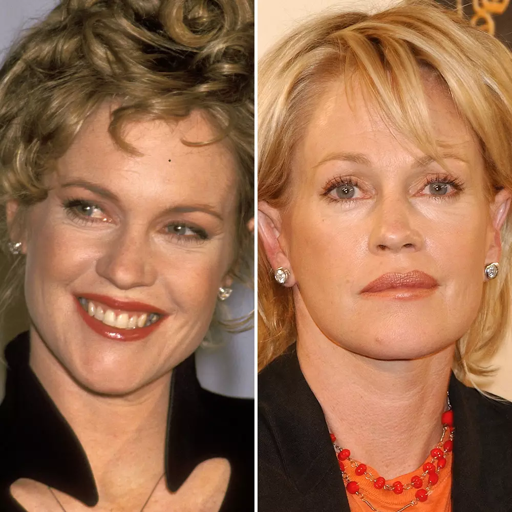 Operasi Melanie griffith