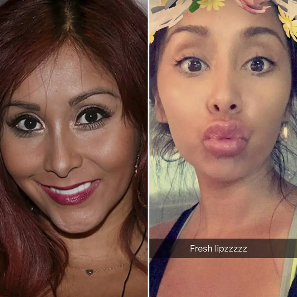 Snooki injeksi lambe