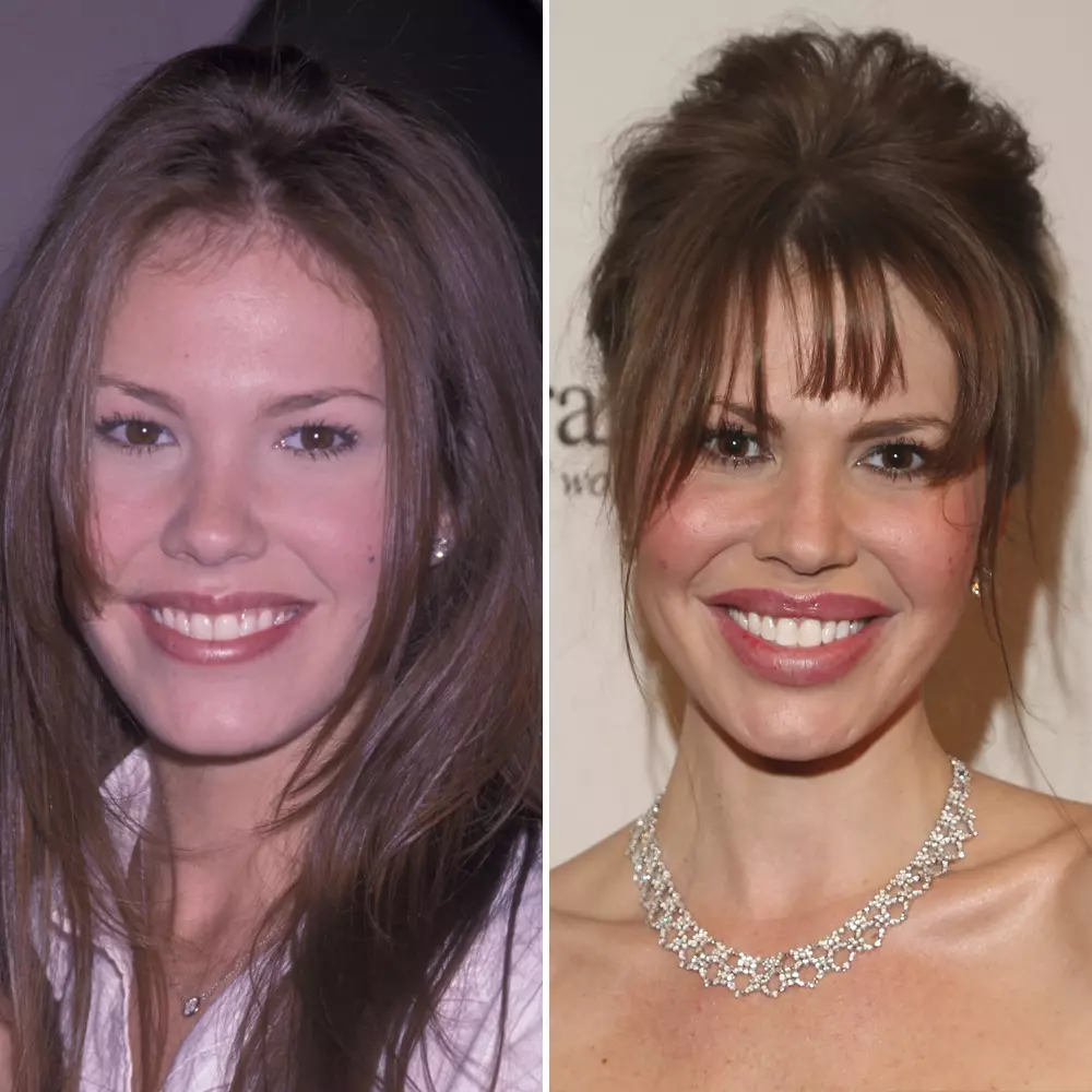 Nikki cox surgery