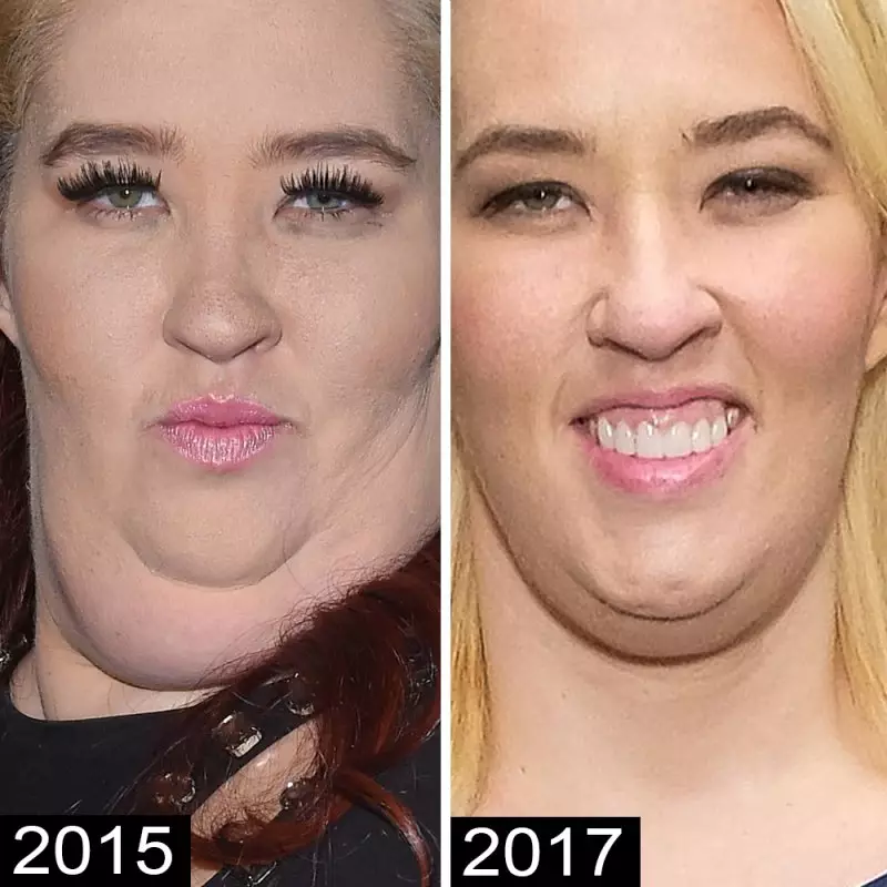 Mama june chin uli