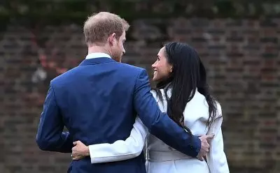 prince Harry balding