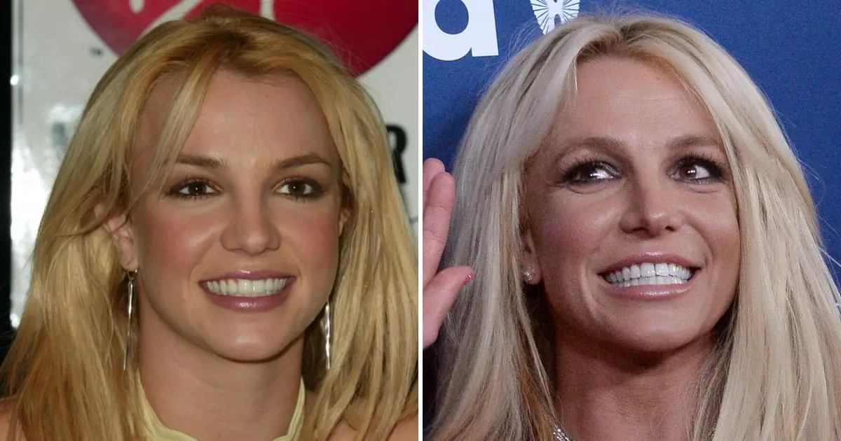 A u bë Britney Spears një operacion plastik? Fotot e saj të transformimit
