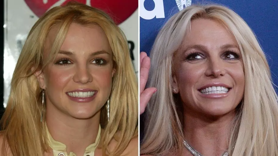 Britney Spears kwetara na ọ tụlere inweta ịwa ahụ plastik: Lee foto nke mgbanwe ya