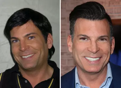 David Tutera plastic surgery