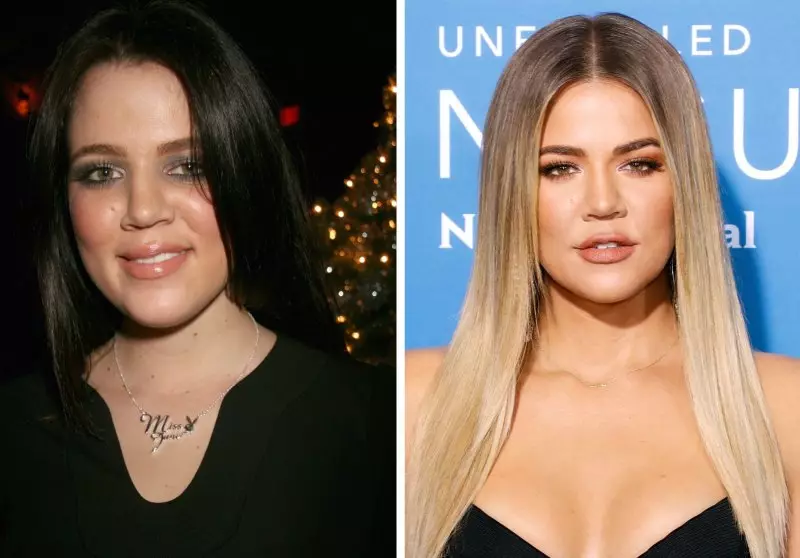 Khloe kardashian przed i po operacji plastycznej