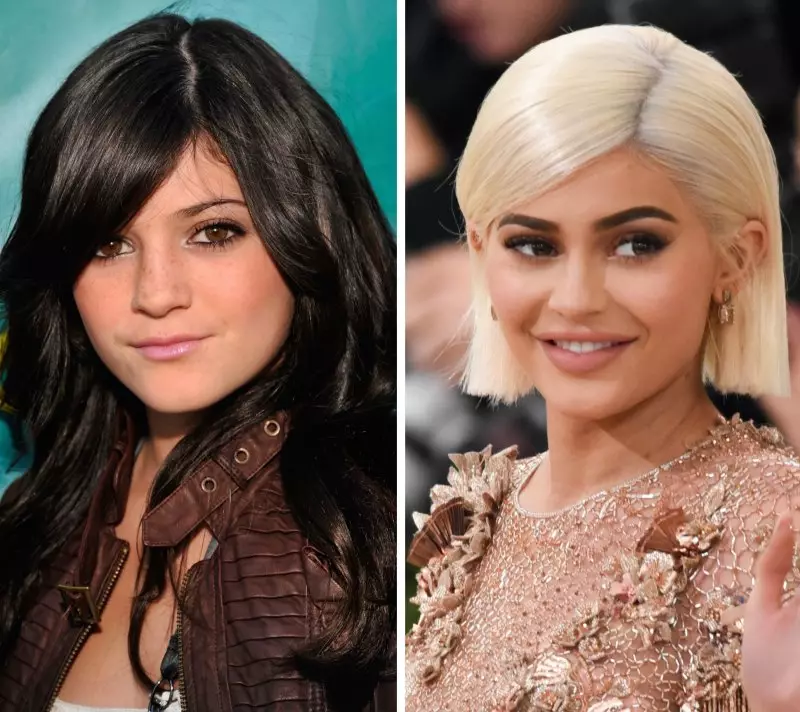 Kylie Jenner plastik jarrohlikdan oldin va keyin