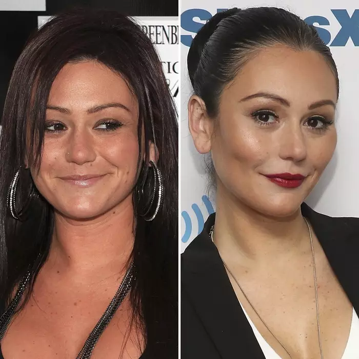 Chirurgie plastica jwoww