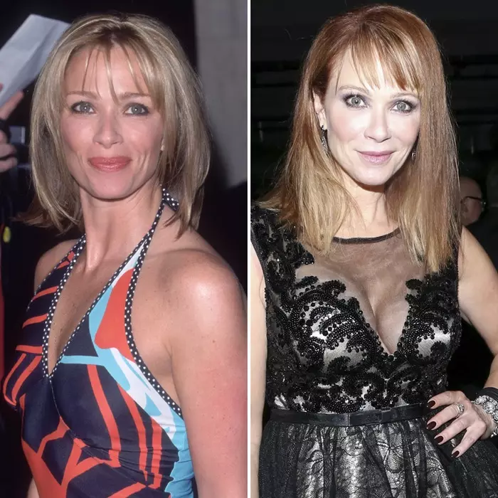 Lauren Holly plastik cərrahiyyə