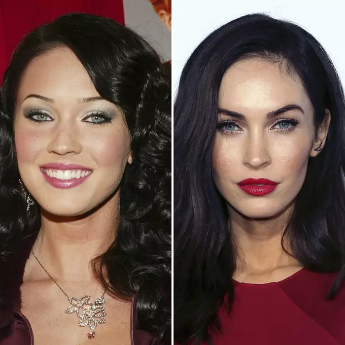 Chirurgie plastică megan fox